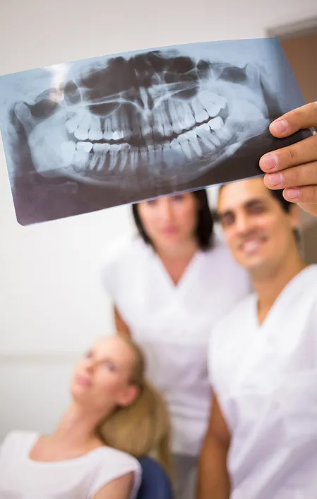 Impacted Wisdom teeth - Dental at Keys